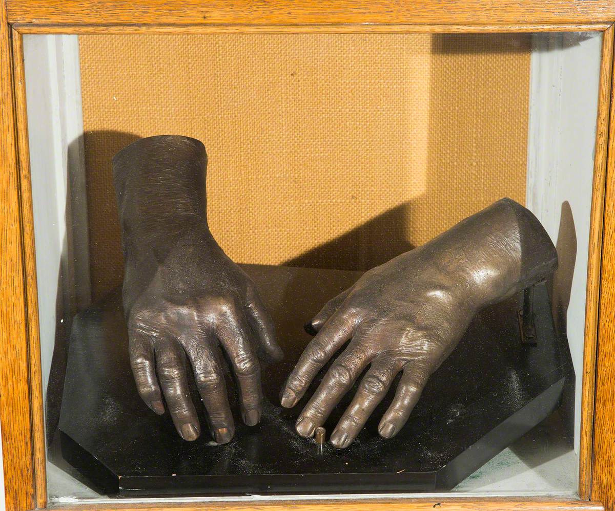 Berkeley Moynihan (1865–1936), with a Cast of Moynihan's Hands | Art UK