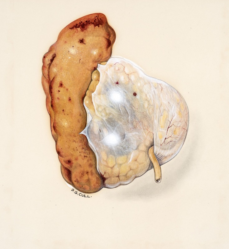 Dissected Kidney | Art UK